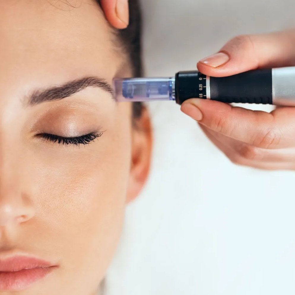 Exceed Microneedling – Skin To Heart Australia